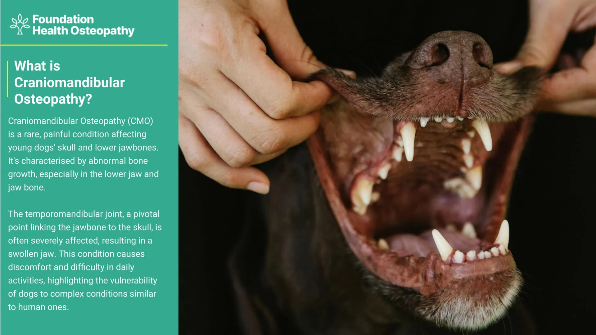 Craniomandibular Osteopathy | Foundation Health Osteopathy | 02 6681 ...